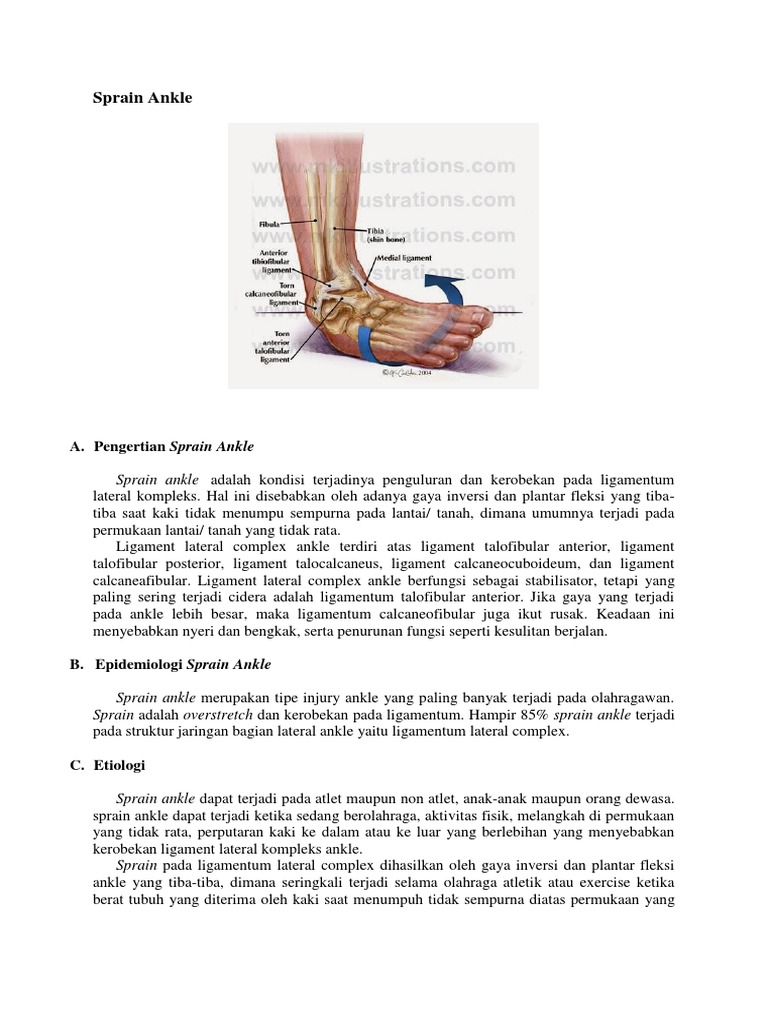 Sprain Ankle | PDF
