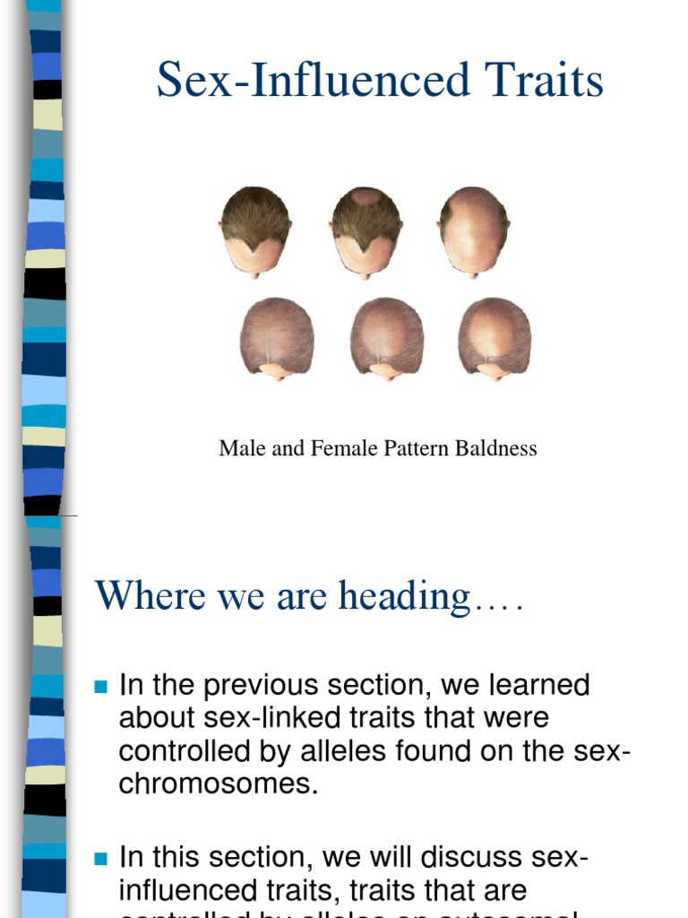 Sex Influenced Traits Male And Female Pattern Baldness Genotype