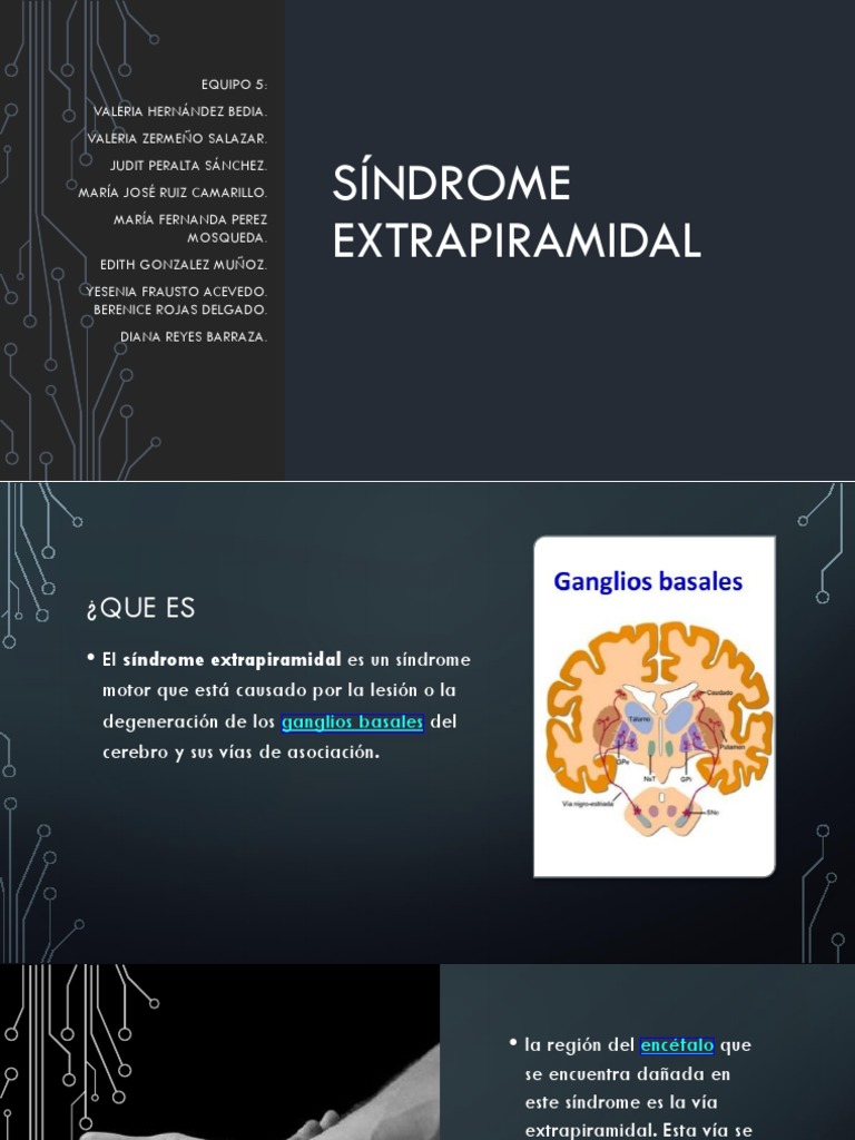 Síndrome Extrapiramidal | PDF