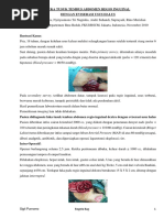 Contusio Musculorum | PDF