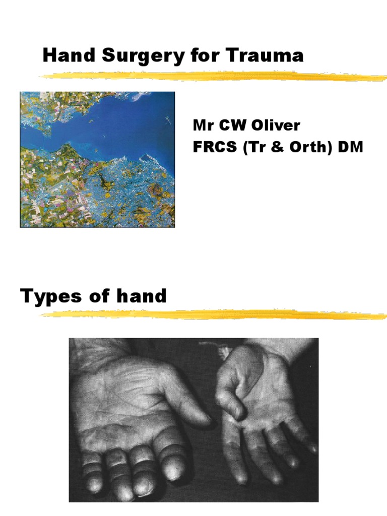 Hand Surgery Trauma Ortho | PDF | Hand | Amputation