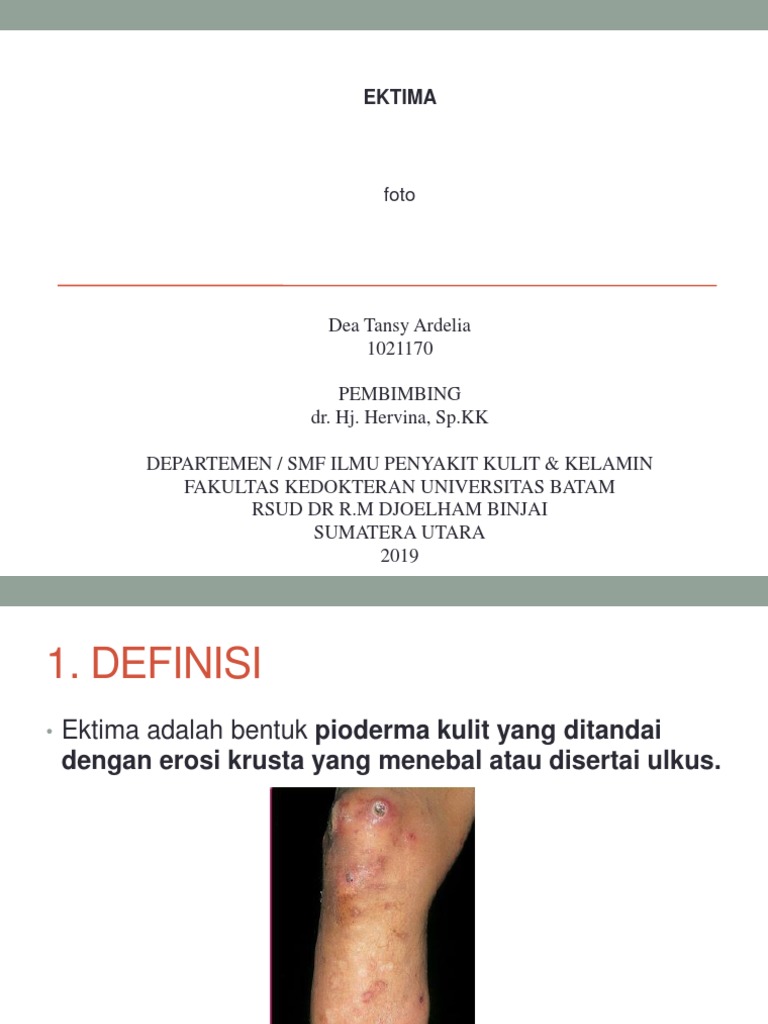 Ektima | PDF