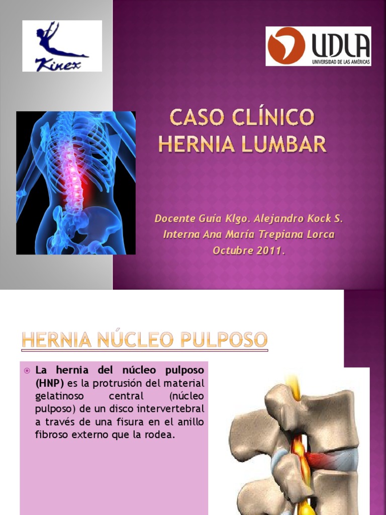 HNP Lumbar | PDF | Sistema musculoesquelético | Anatomía humana