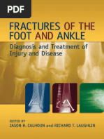 EMRA SportsMedicine Splint Guide | PDF | Thumb | Hand