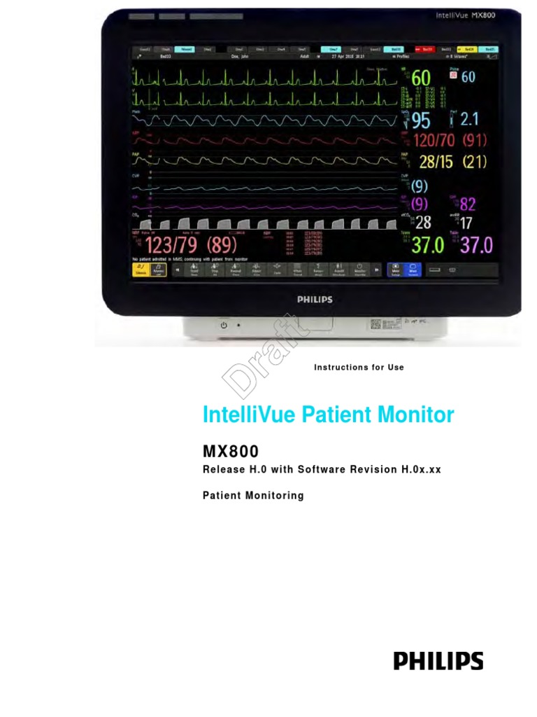 Intellivue mx800 PDF | PDF | Electrocardiography | Computer Monitor