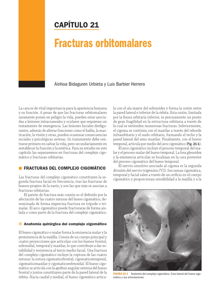 Fracturas orbitomalar | PDF | Sistema musculoesquelético | Cabeza y ...