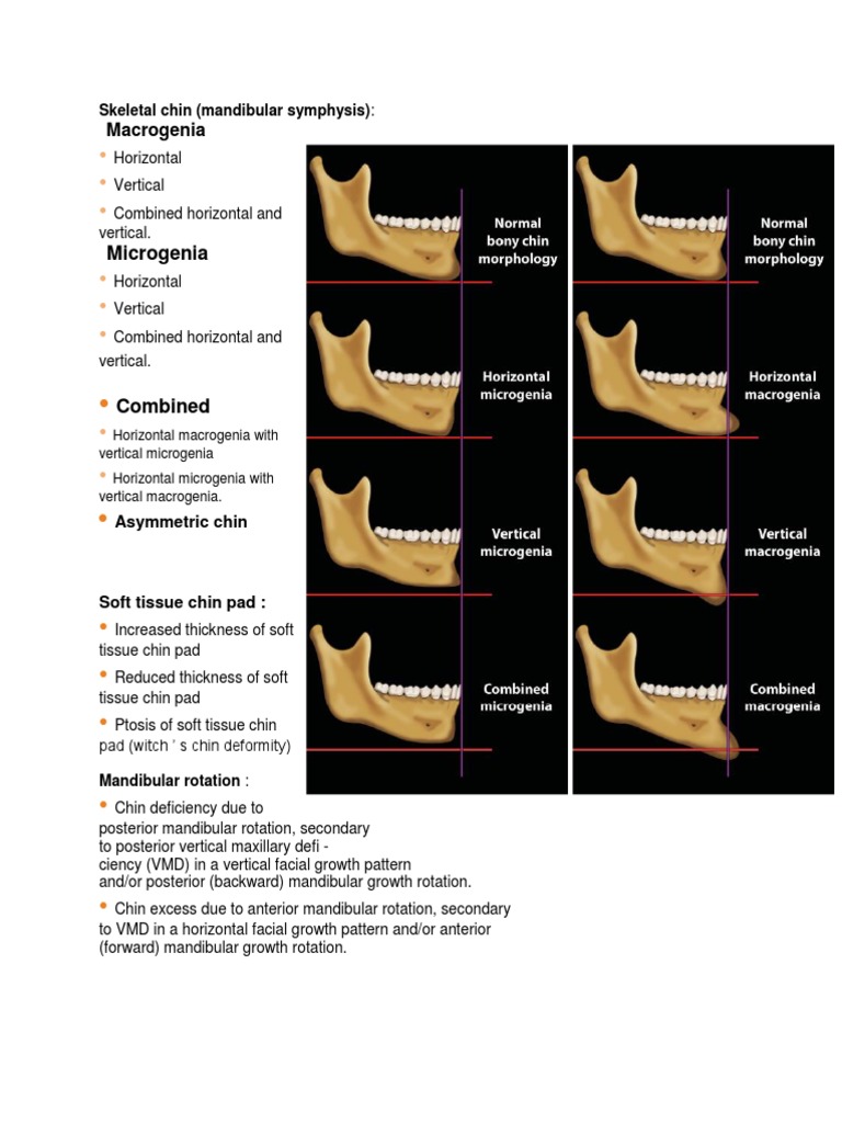 Chin Deformities: Types and Causes | PDF