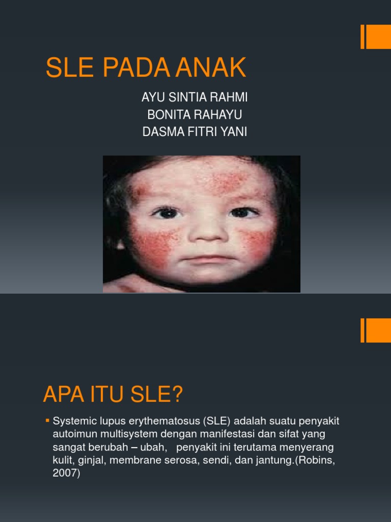 Sle Pada Anak | PDF | Pengembangan Diri | Kesehatan Holistik
