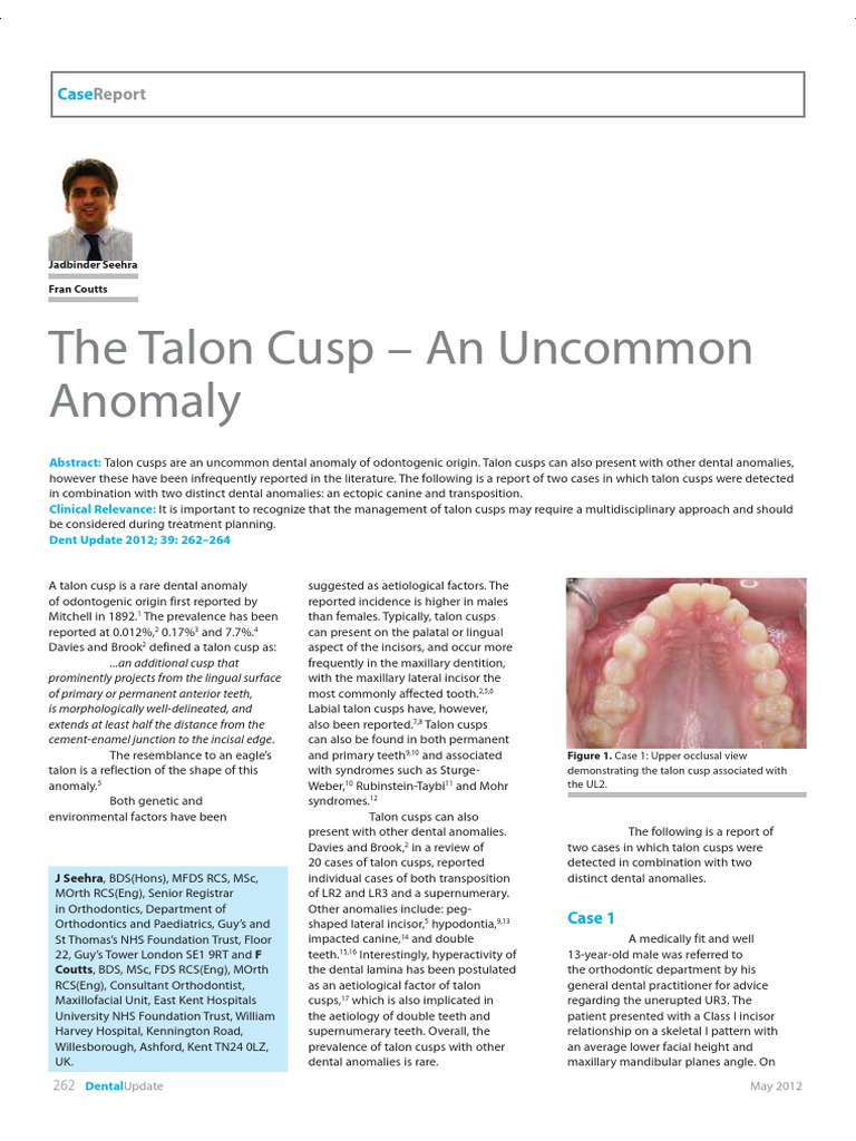 A Talon Cusp PDF | Download Free PDF | Orthodontics | Face