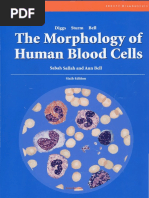 Sickle Cell Crisis | PDF | Anemia | Red Blood Cell