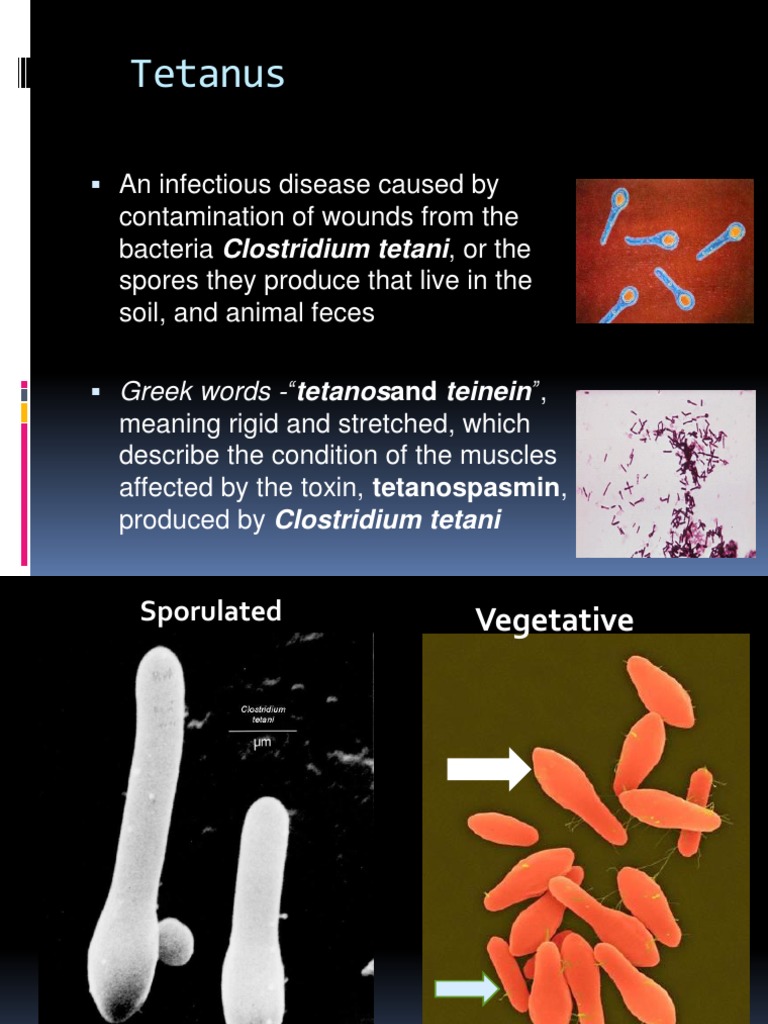 An In-Depth Look at Tetanus: Causes, Symptoms, Diagnosis, Treatment and ...