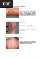 Perbedaan Erosi Dan Ekskoriasi | PDF