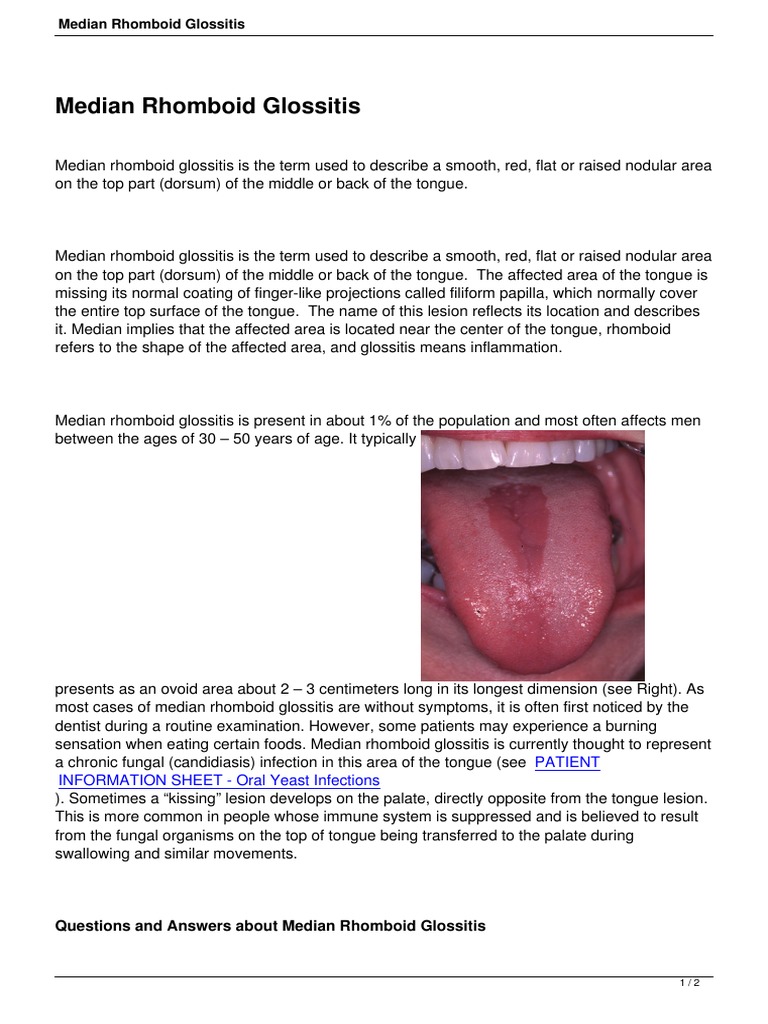 Median Rhomboid Glossitis | PDF | Tongue | Medical Diagnosis