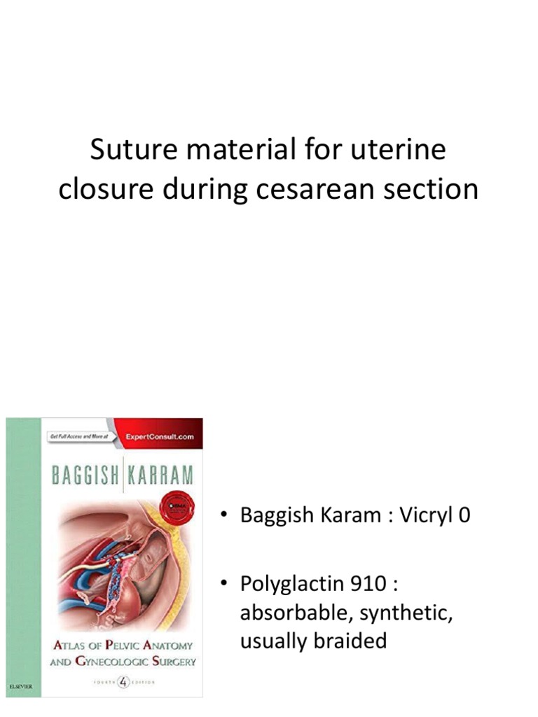 Suture Material For Uterine Closure During Cesarean Section | PDF