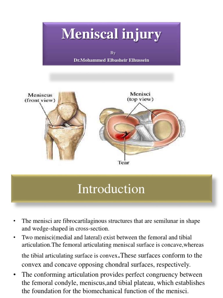 Meniscal Injury Overview and Treatment | PDF | Knee | Joints
