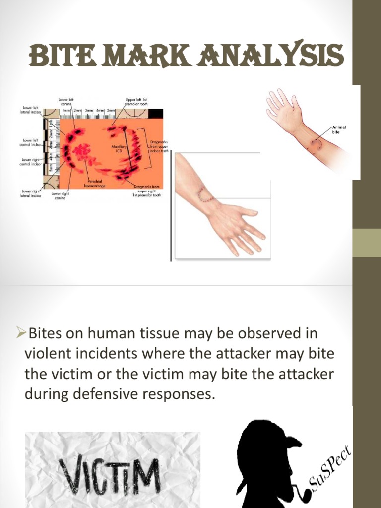 Human Bite Mark Analysis | PDF | Science & Mathematics