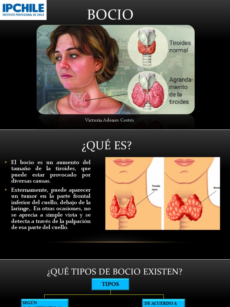 BOCIO | Descargar gratis PDF | Tiroides | Glándulas