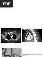 Birads Poster | Mammography | Breast