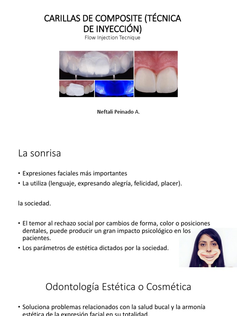 Carillas Inyectadas de Composite: Técnica y Proceso | PDF | Compuesto ...