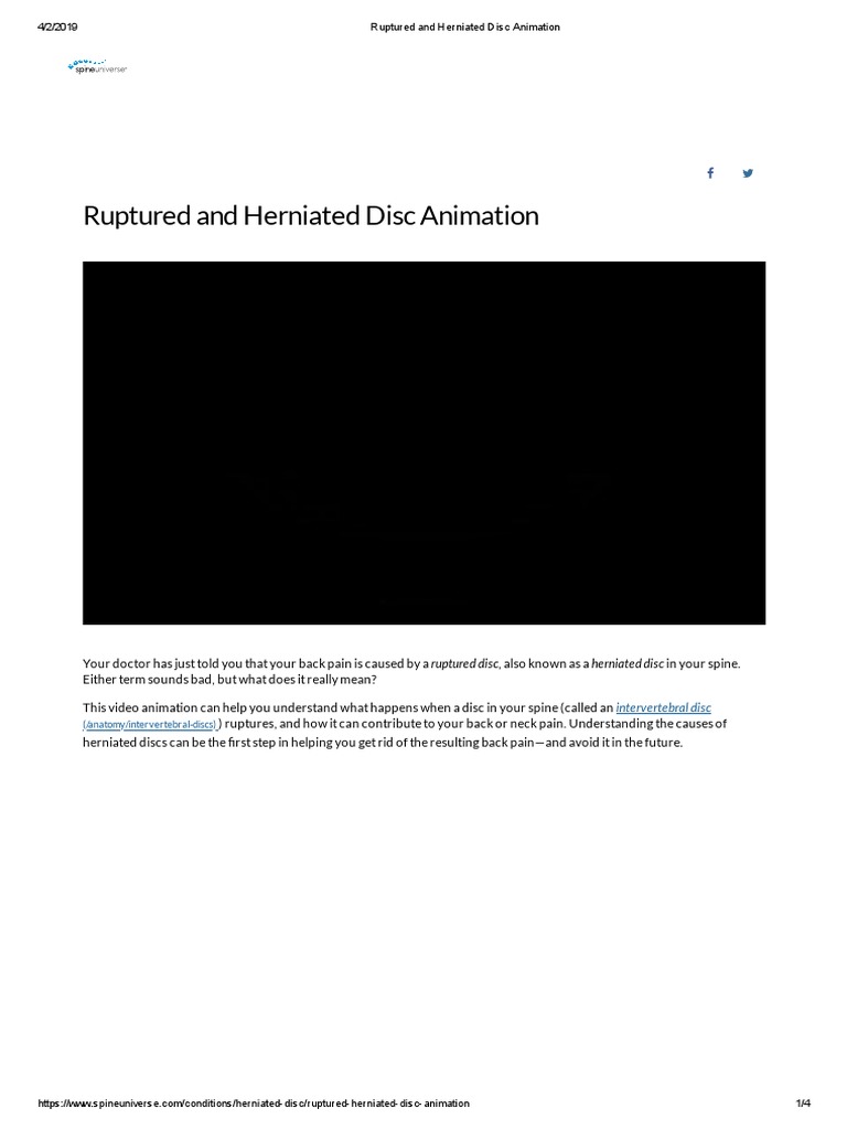 Ruptured and Herniated Disc Animation | PDF | Vertebral Column ...