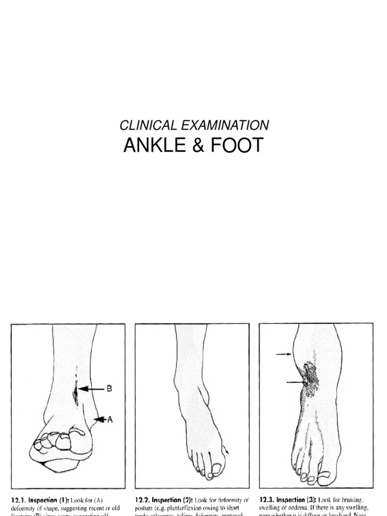 Physical Examination of The Ankle and Foot. Johanes | PDF | Ankle | Foot