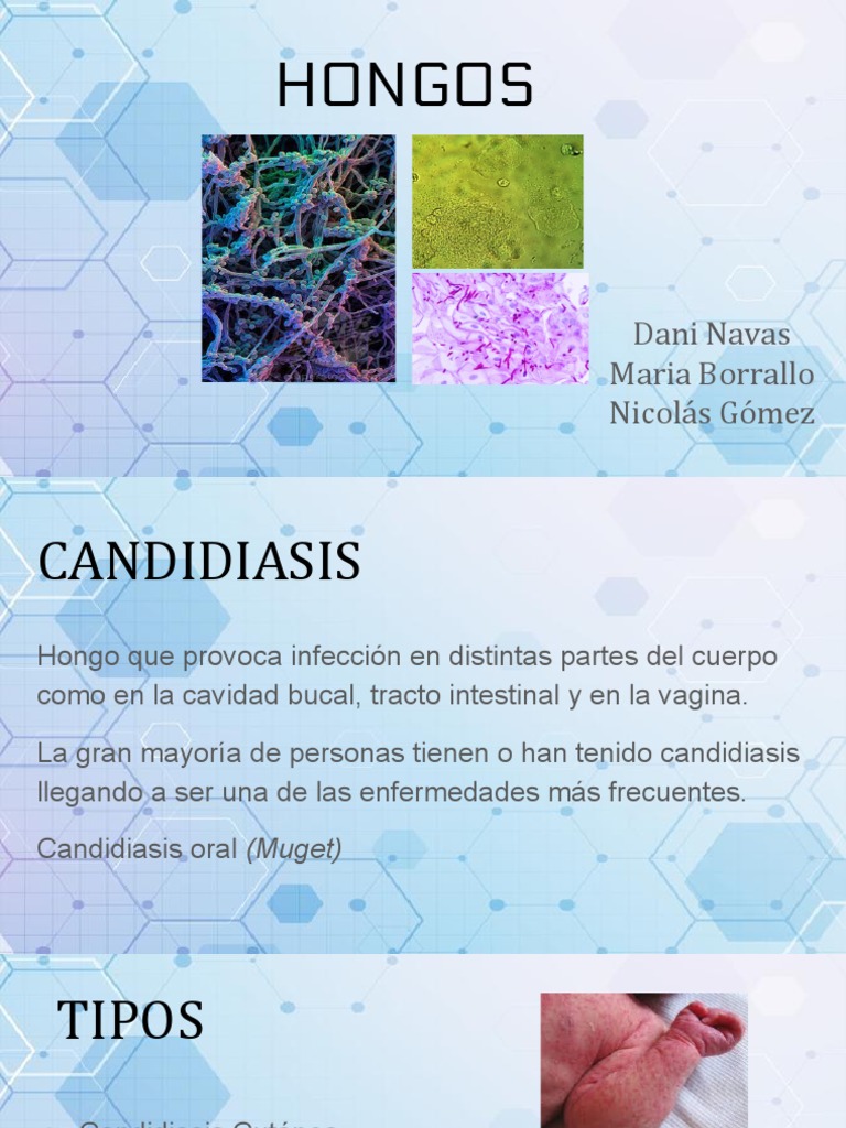 Hongos (Candida) | Candidiasis | Especialidades Medicas