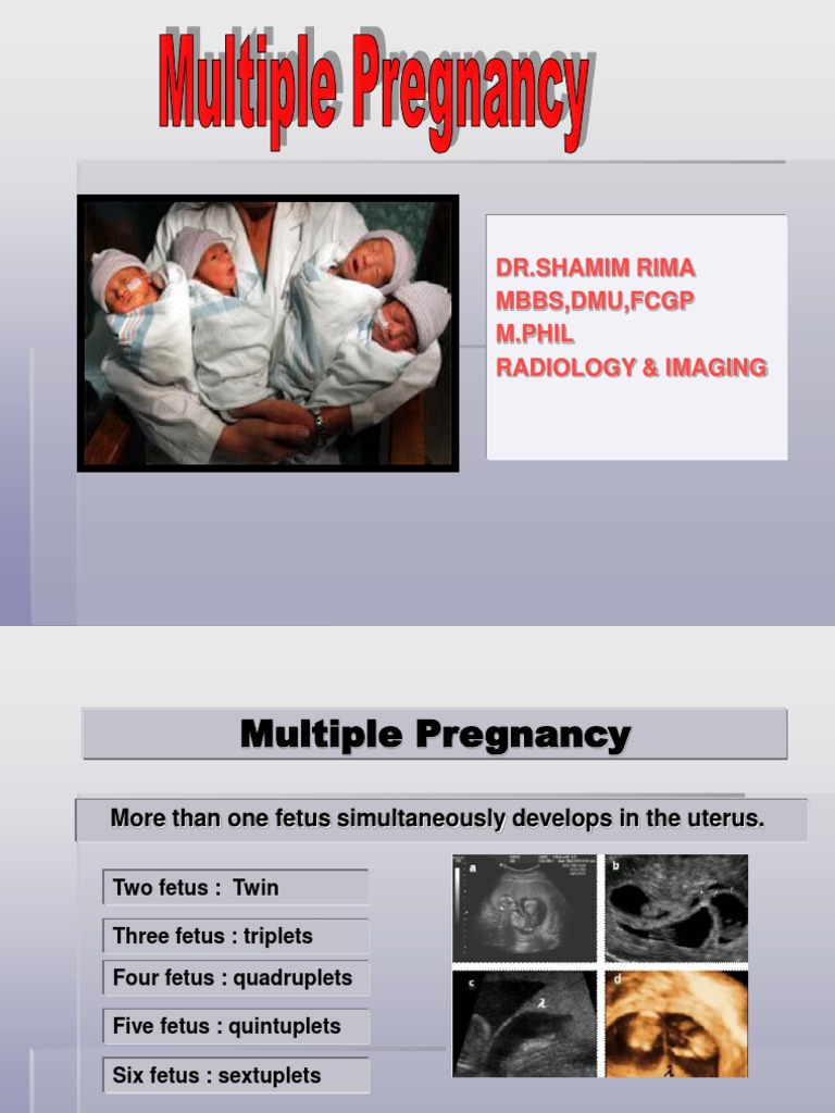 Multiple Pregnancy | PDF | Multiple Births | Twin