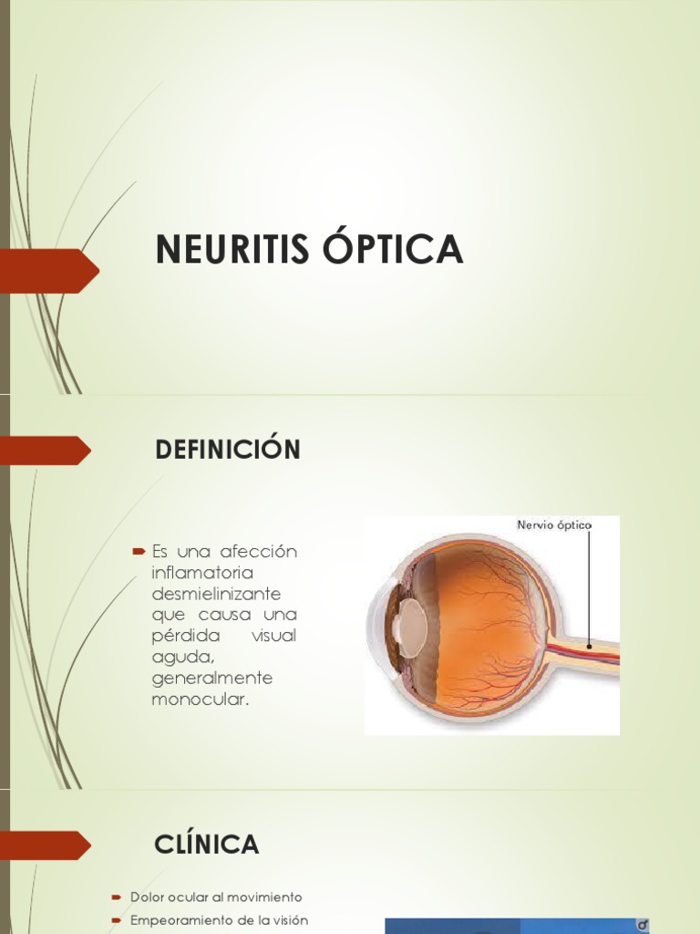 Neuritis Optica | PDF | Especialidades Medicas | Medicina CLINICA