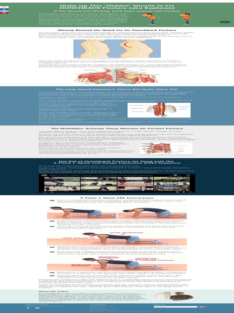 Wake Up This "Hidden" Muscle To Fix HUNCHBACK Posture (Aka Kyphosis ...