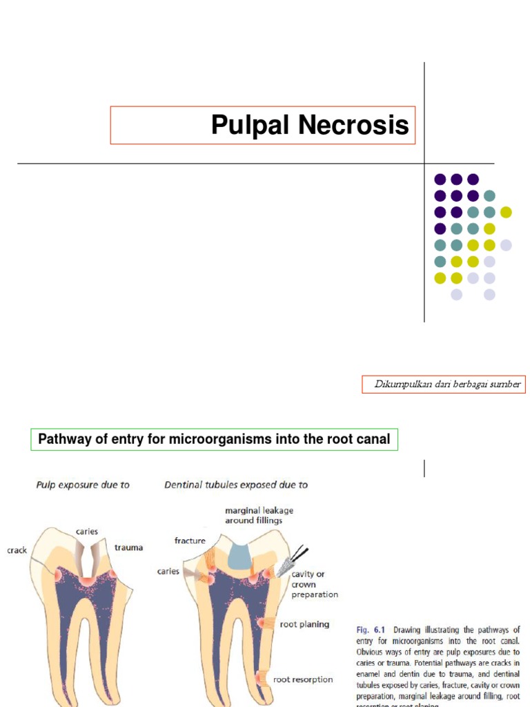 PPDGS Konservasi Lecture4a Pulp Necrotic | PDF | Human Tooth | Medical ...