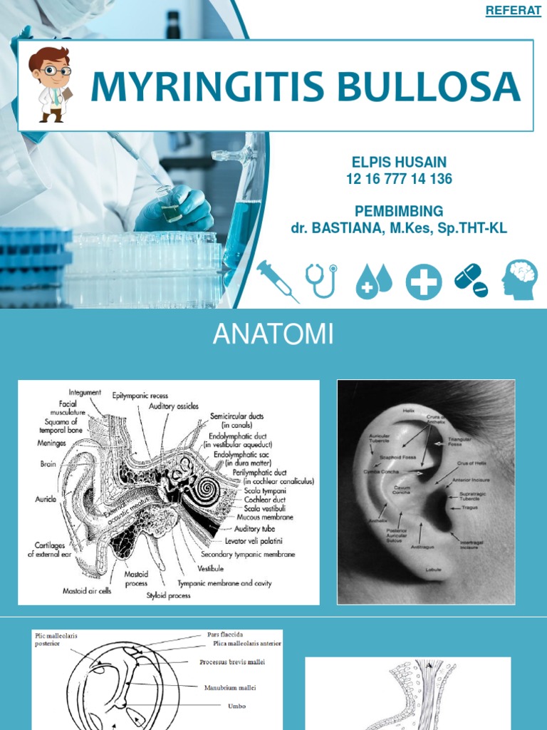 Myringitis Bullosa: Elpis Husain 12 16 777 14 136 Pembimbing Dr ...