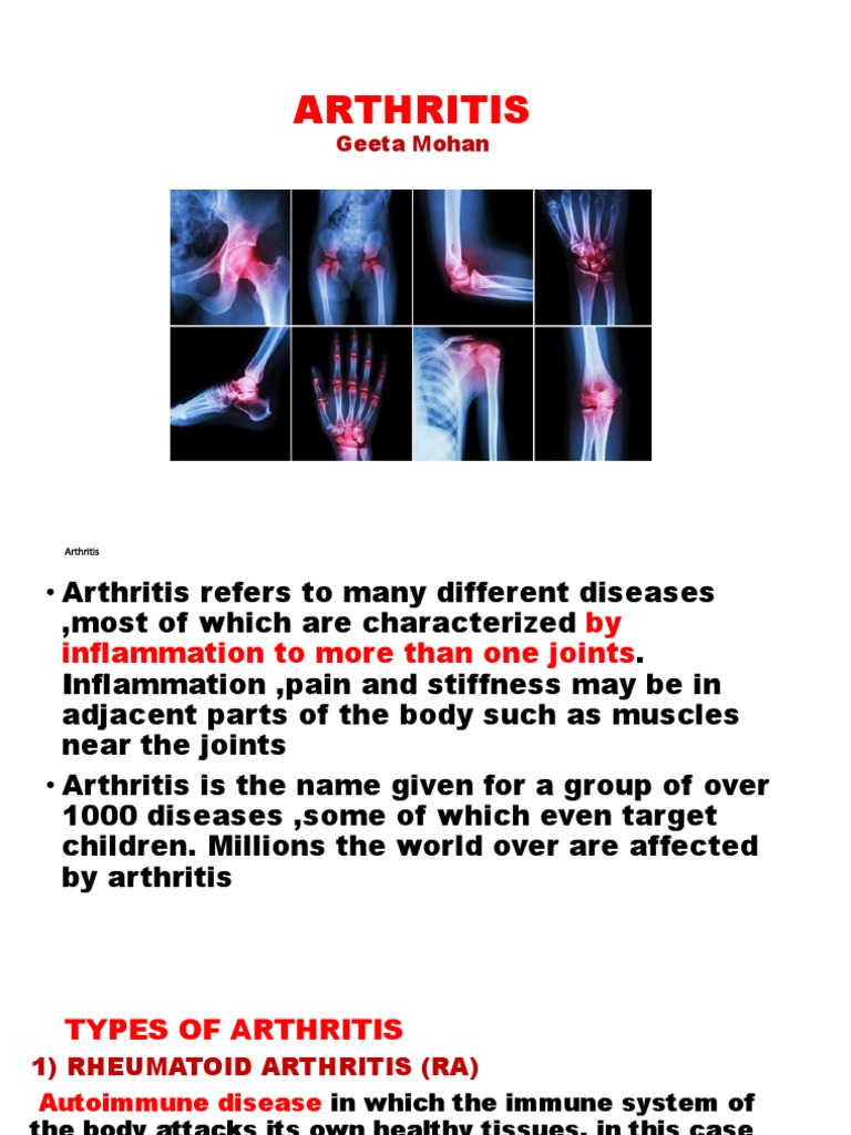 Arthritis | PDF | Arthritis | Joint