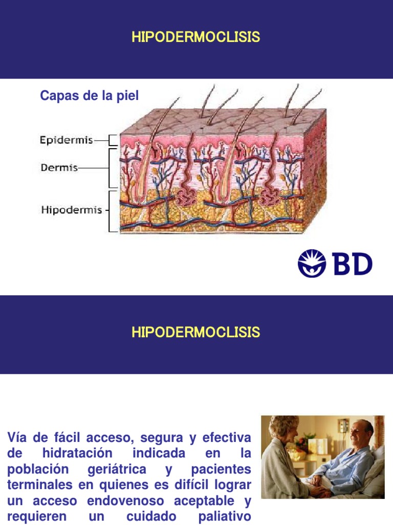 Manejo Catéter Periférico Subcutáneo | Medicina | Medicina CLINICA