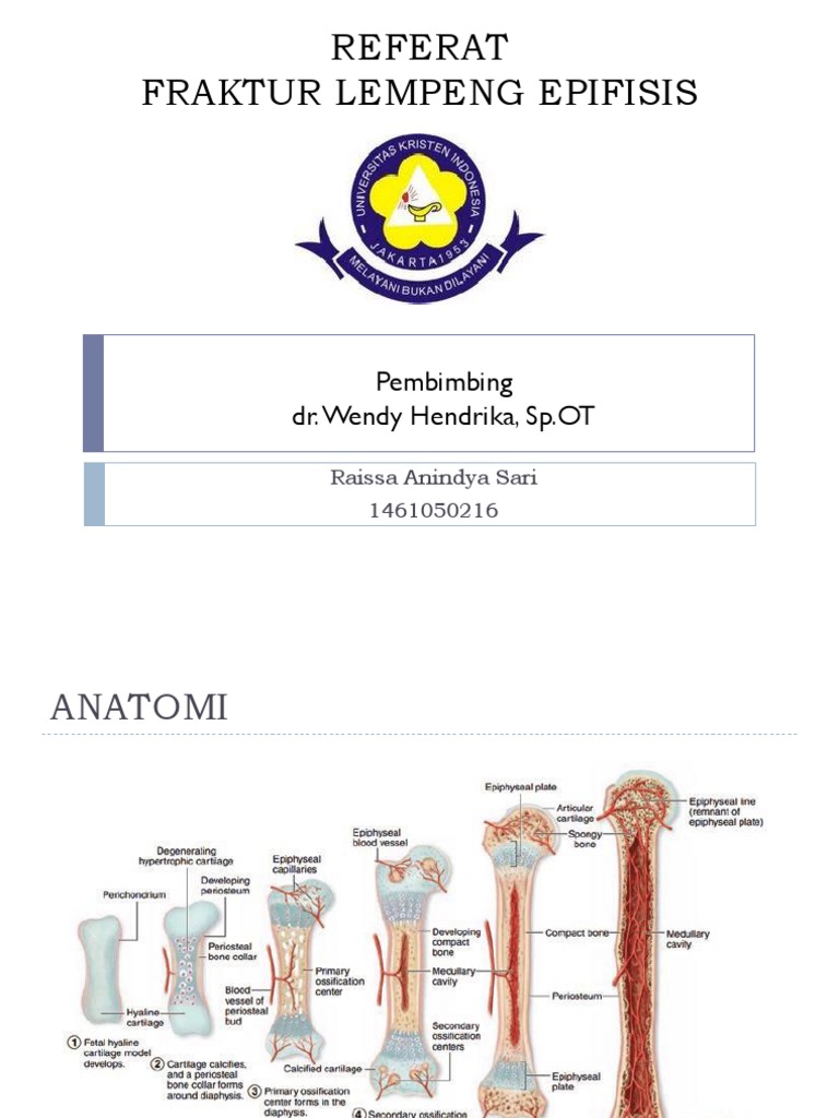 Fraktur Lempeng Epifisis | PDF