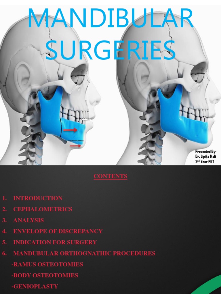 Mandibular Surgeries | PDF | Dental Anatomy | Mouth