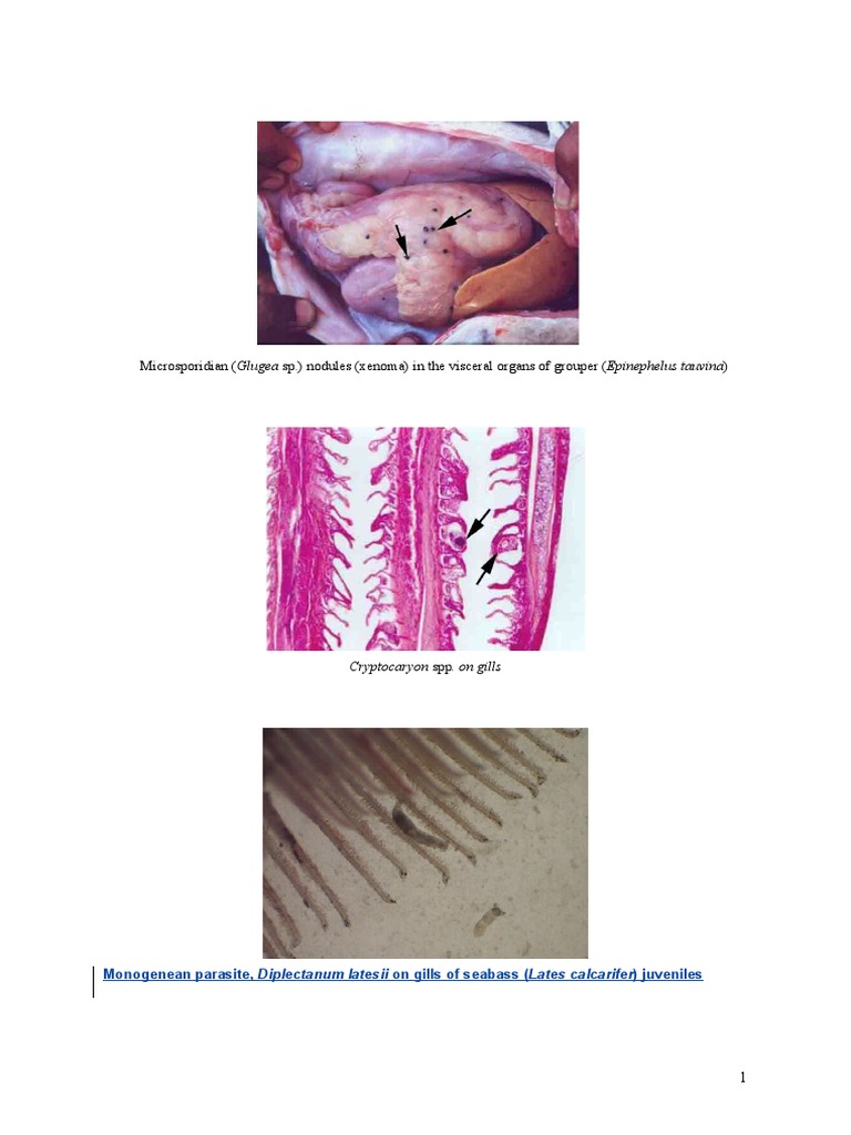 Microsporidian (Glugea SP.) Nodules (Xenoma) in The Visceral Organs of ...