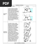 Signo del Psoas y Apendicitis | PDF