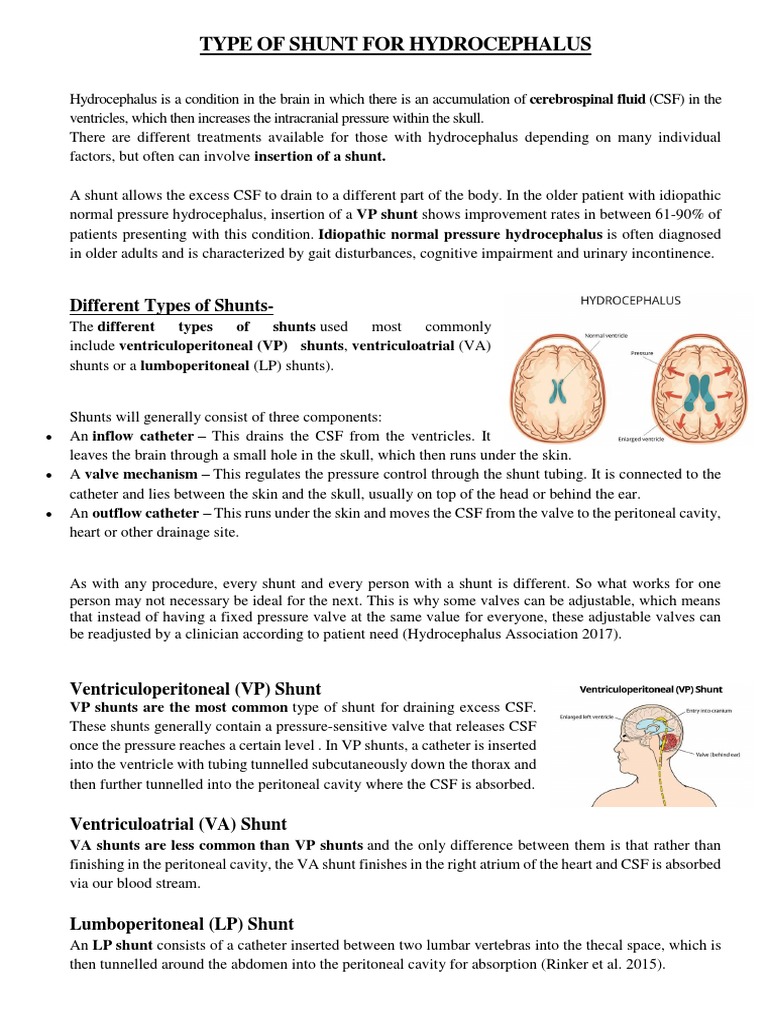 Type of Shunt For Hydrocephalus | PDF | Cerebrospinal Fluid | Epidemiology