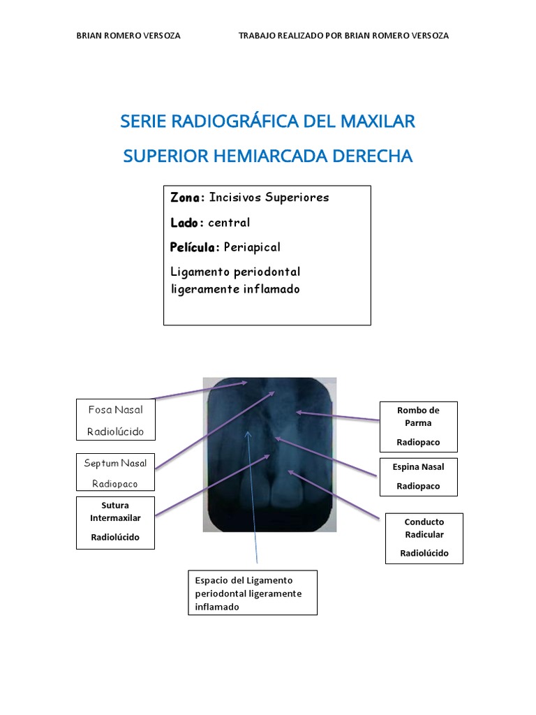 Serie Radiográfica Del Maxilar Superior Hemiarcada Derecha y Izquierda ...