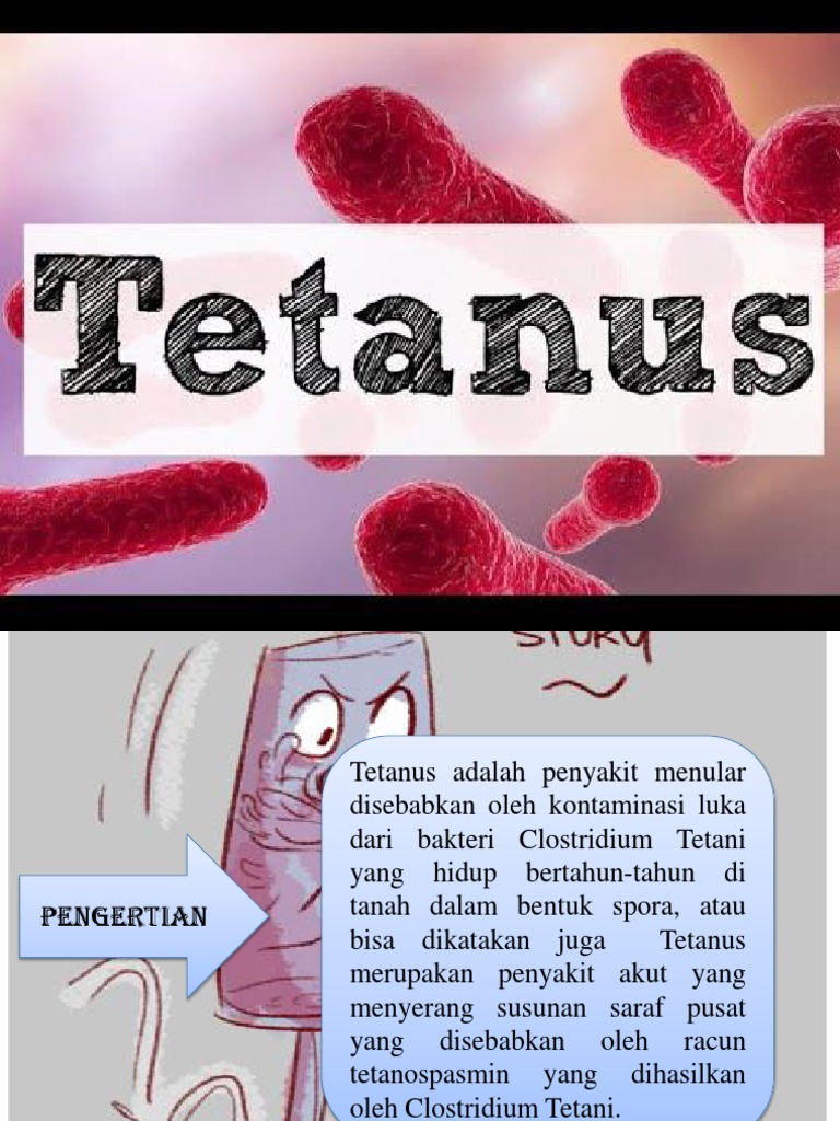 Tetanus | PDF