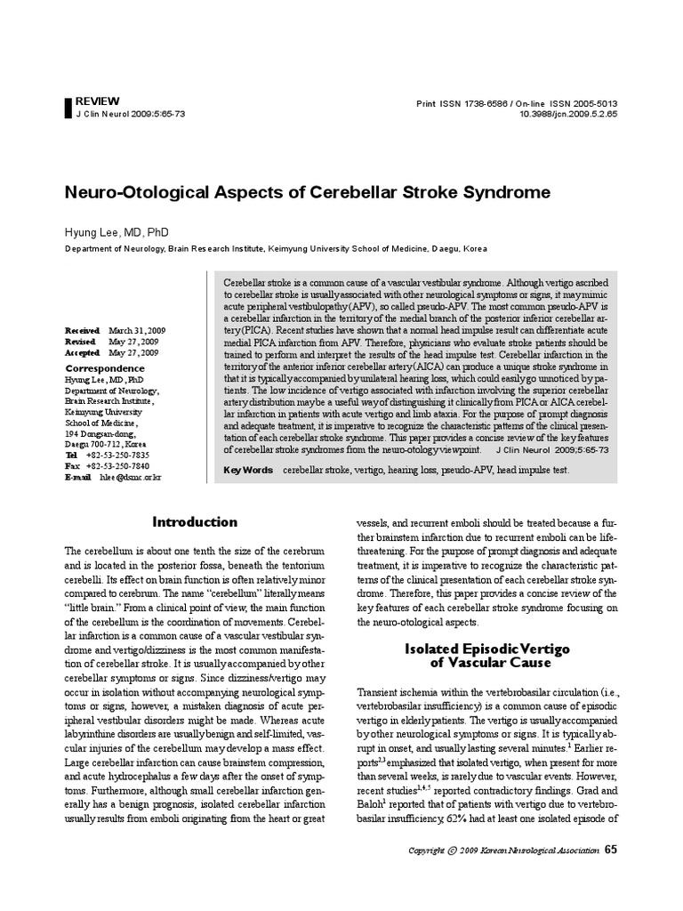 AICA Vs SCA Vs PICA | PDF | Vertigo | Cerebellum