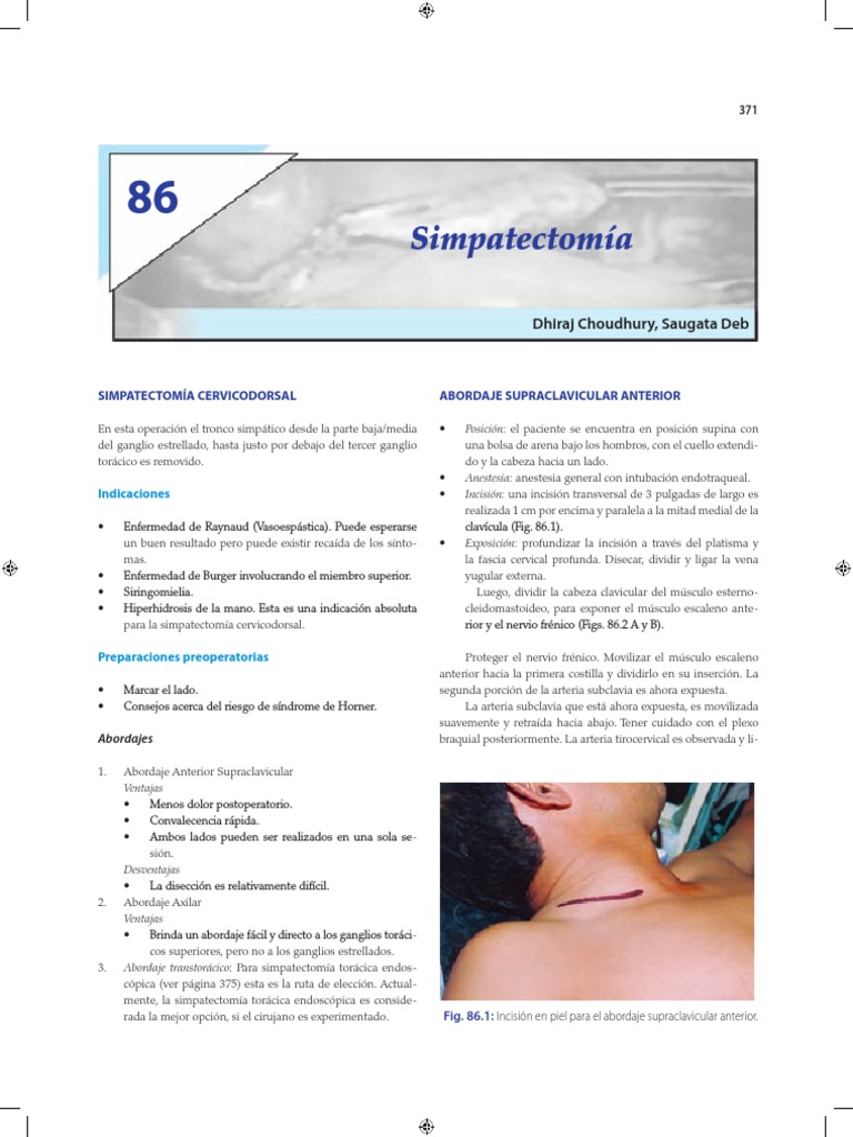 Simpatectomía: Procedimientos y Técnicas | PDF | Anatomía humana ...