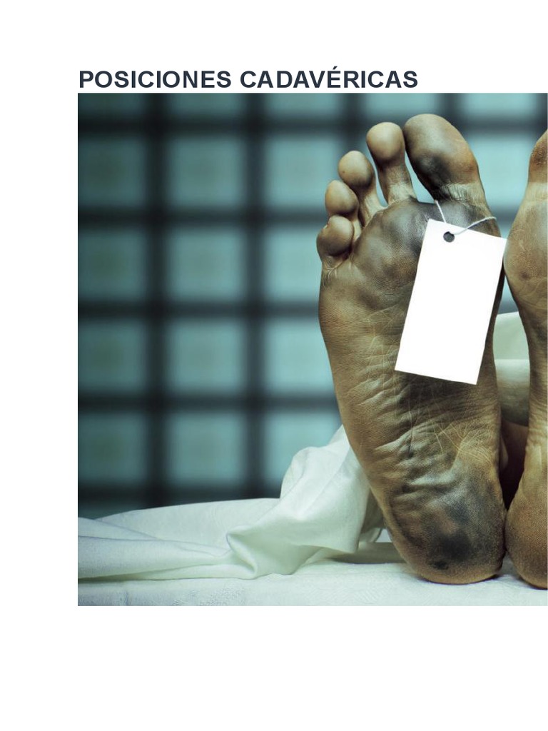 Posiciones Cadavéricas | PDF