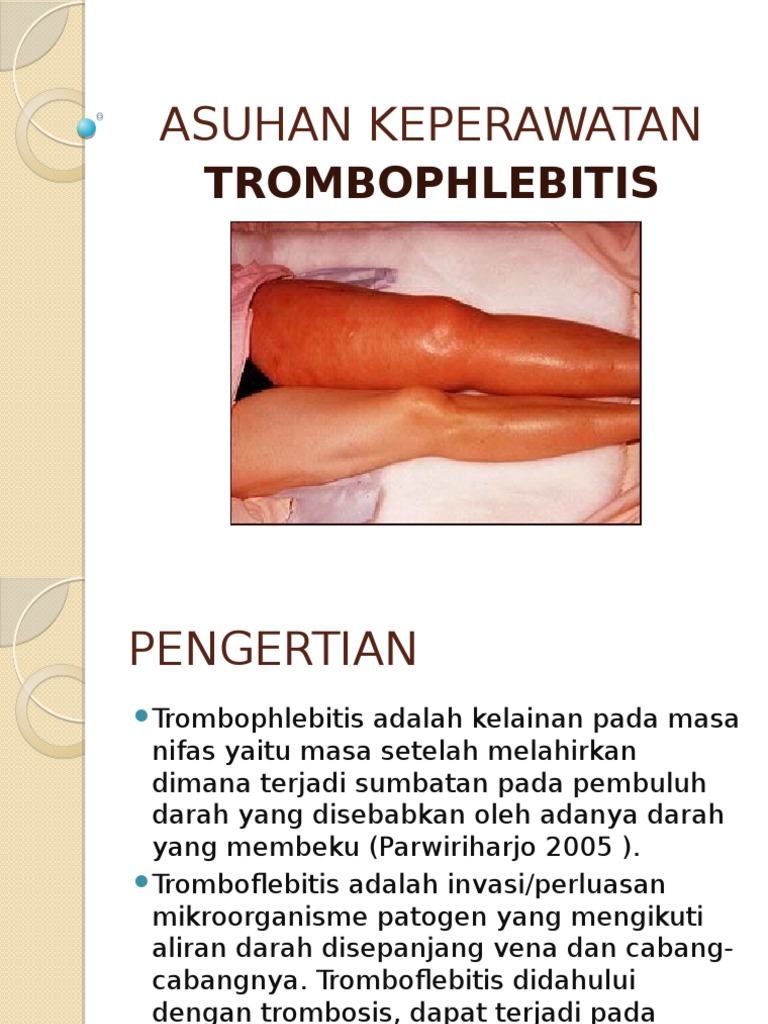 Asuhan Keperawatan Thrombophlebitis | PDF