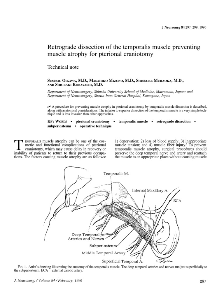 (Journal of Neurosurgery) Retrograde Dissection of The Temporalis ...