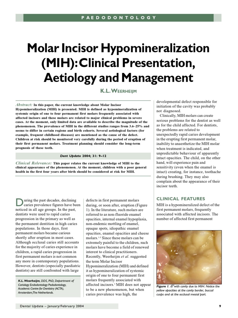 Molar Incisor Hypomineralization (MIH) : Clinical Presentation ...