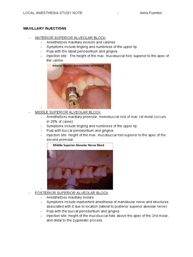 Local Anesthetic Injection Chart - Ofa | PDF | Human Head And Neck ...
