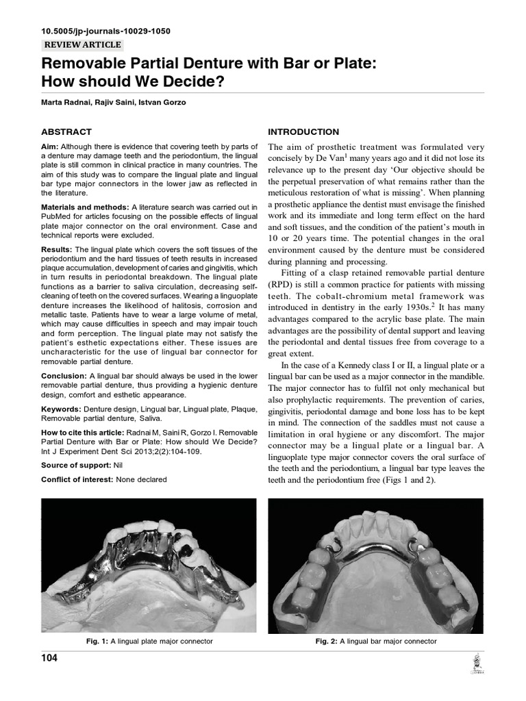Removable Partial Denture With Bar or Plate How Should We Decide | PDF ...