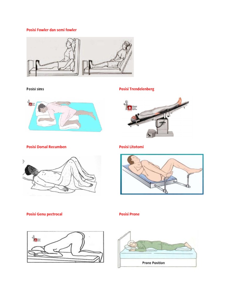 Posisi Fowler Dan Semi Fowler | PDF