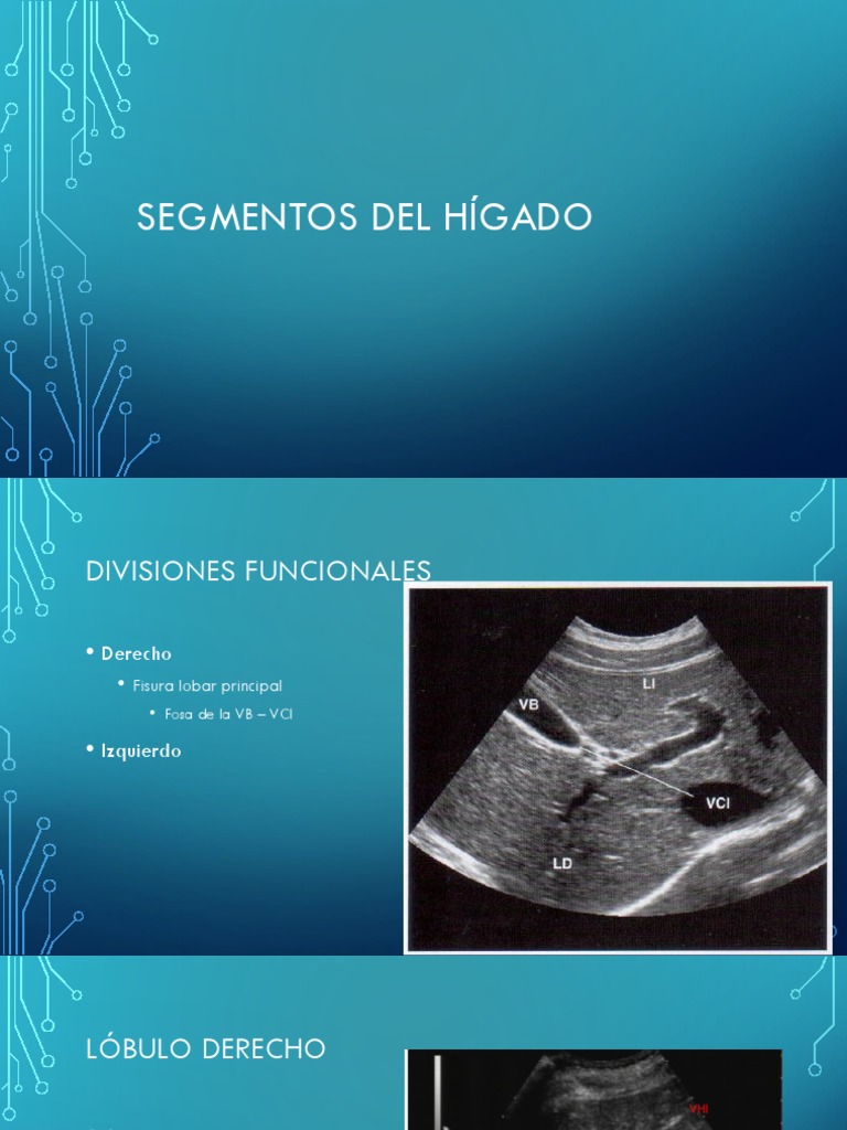 Anatomía Del Hígado 3 | PDF